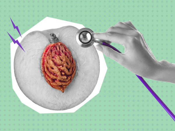 Chapter 4 : 건강 사전 – HPV와 STD, 무슨 차이냐고요? - LETHER